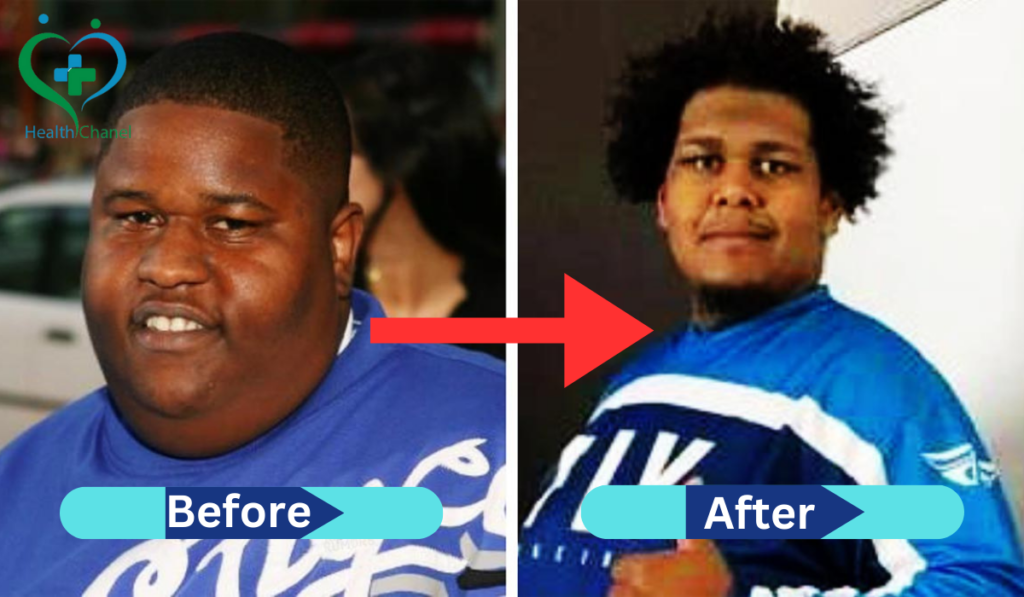 Jamal Mixon's 200-Pound weight Loss Transformation - Health Chanel